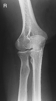 Bontrager's Textbook of Radiographic Positioning and Related Anatomy