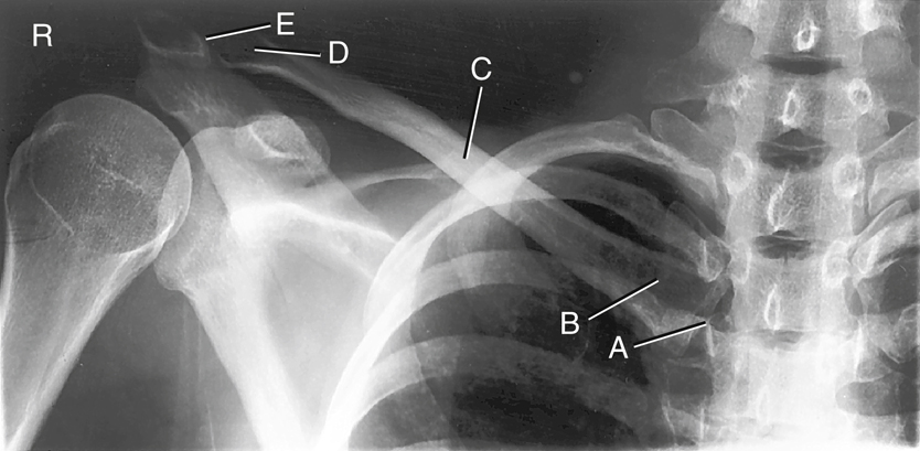 Bontrager's Textbook of Radiographic Positioning and Related Anatomy