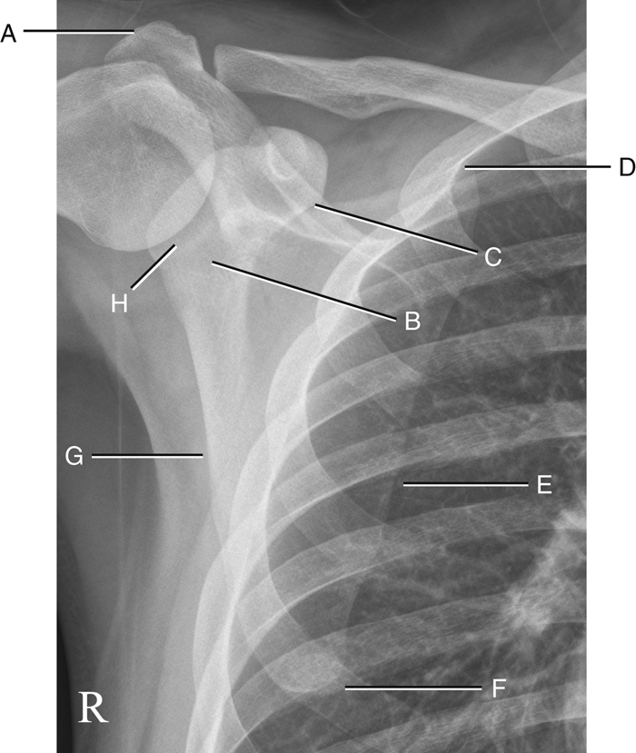 Bontrager's Textbook of Radiographic Positioning and Related Anatomy