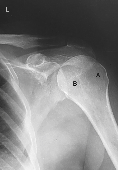 Bontrager's Textbook of Radiographic Positioning and Related Anatomy