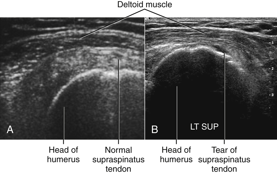 Bontrager's Textbook of Radiographic Positioning and Related Anatomy