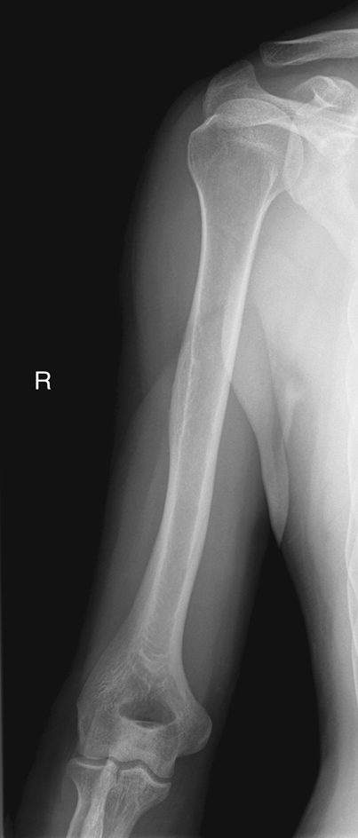 Bontrager's Textbook of Radiographic Positioning and Related Anatomy