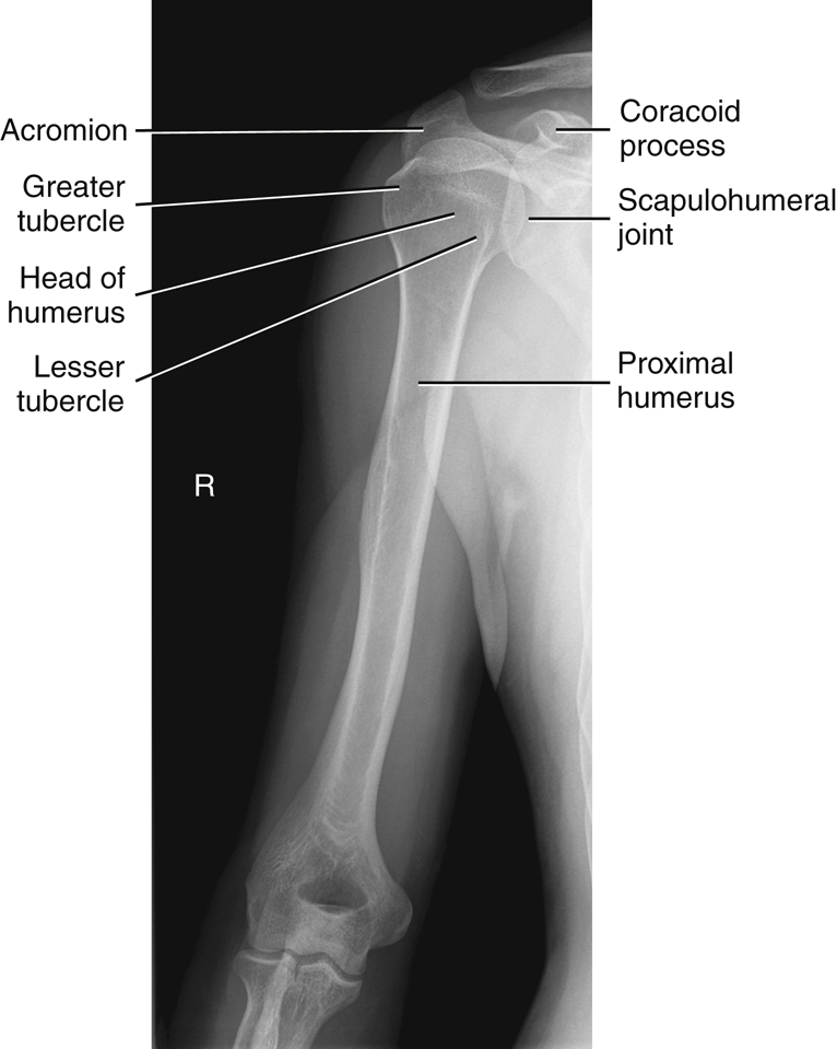 Bontrager's Textbook of Radiographic Positioning and Related Anatomy