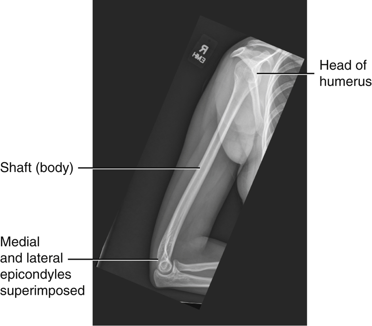 Bontrager's Textbook of Radiographic Positioning and Related Anatomy