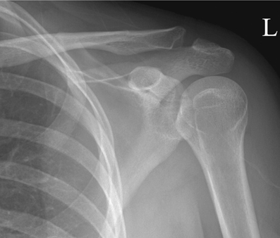 Bontrager's Textbook of Radiographic Positioning and Related Anatomy