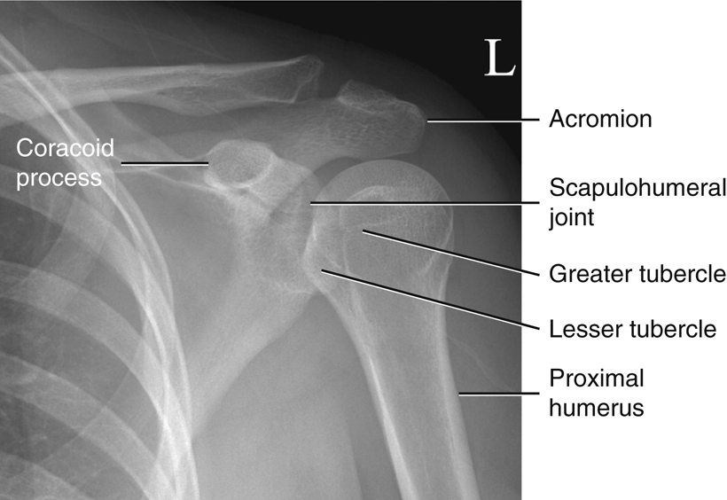 Bontrager's Textbook of Radiographic Positioning and Related Anatomy