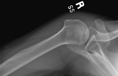 Bontrager's Textbook of Radiographic Positioning and Related Anatomy