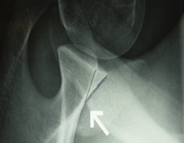 Bontrager's Textbook of Radiographic Positioning and Related Anatomy