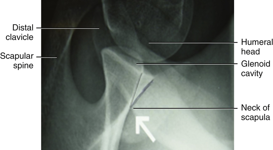 Bontrager's Textbook of Radiographic Positioning and Related Anatomy