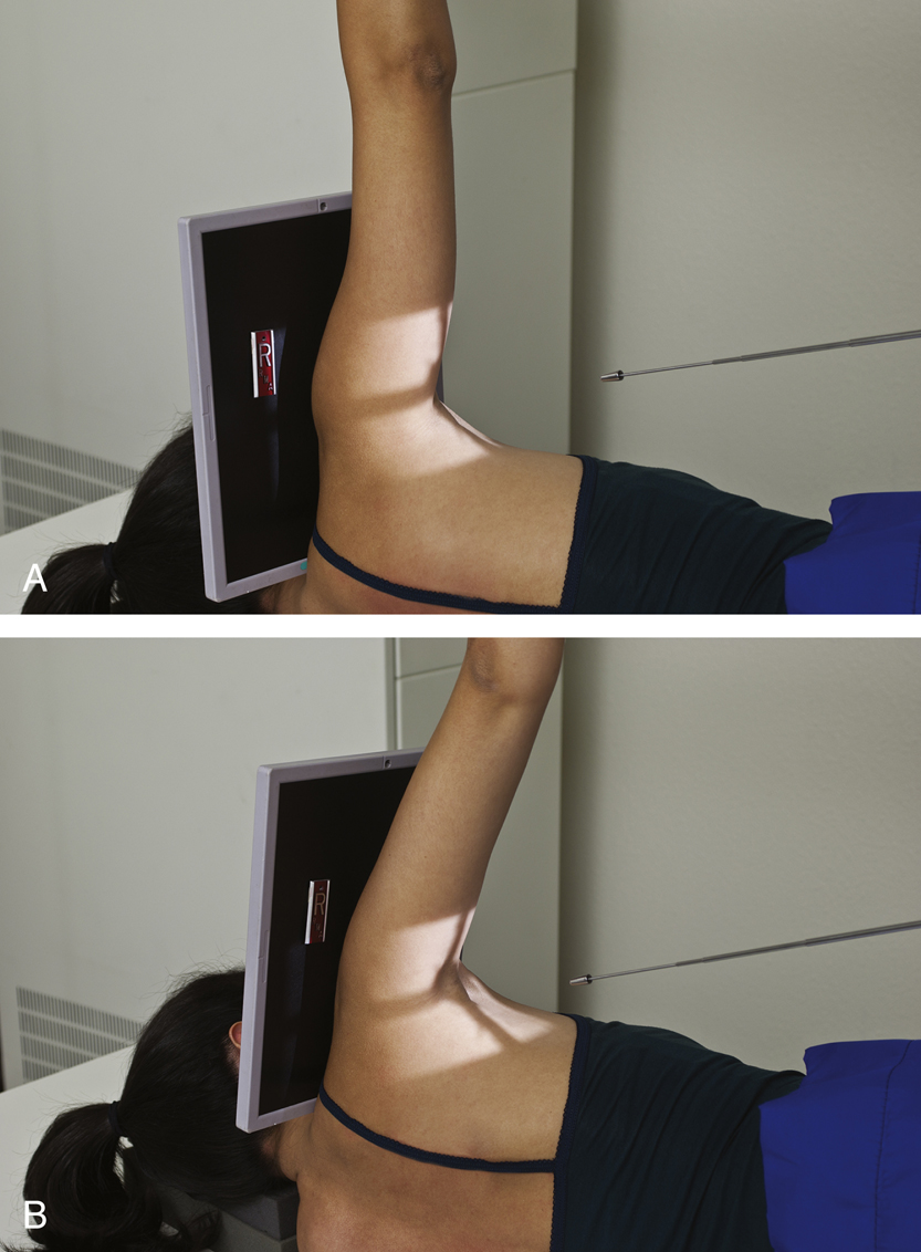 Bontrager's Textbook of Radiographic Positioning and Related Anatomy