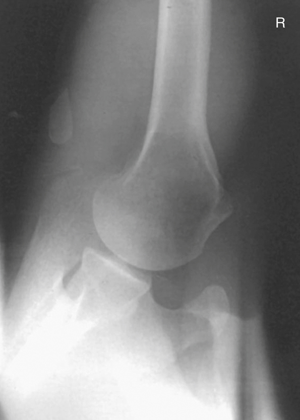 Bontrager's Textbook of Radiographic Positioning and Related Anatomy