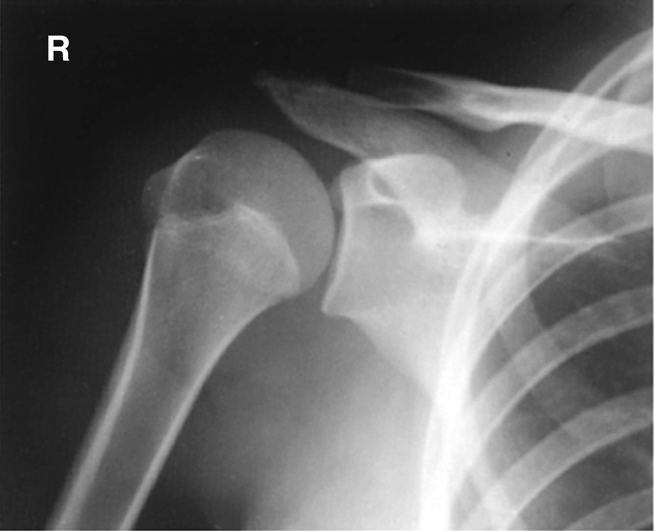 Bontrager's Textbook of Radiographic Positioning and Related Anatomy