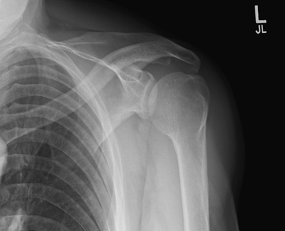 Bontrager's Textbook of Radiographic Positioning and Related Anatomy