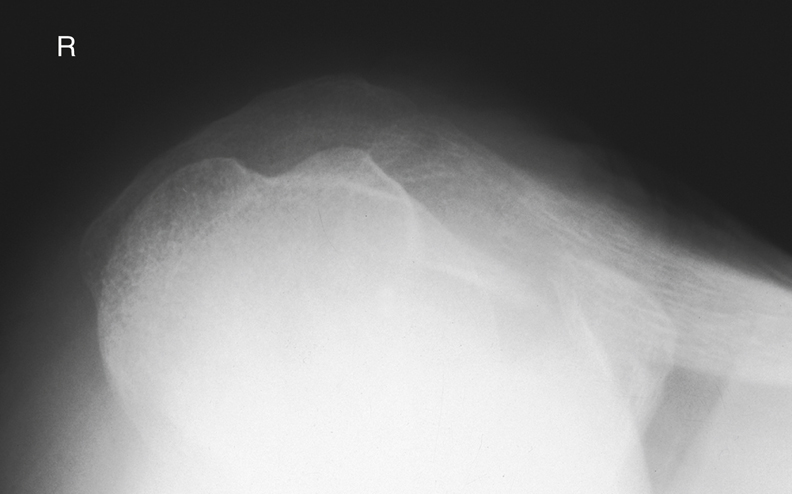 Bontrager's Textbook of Radiographic Positioning and Related Anatomy