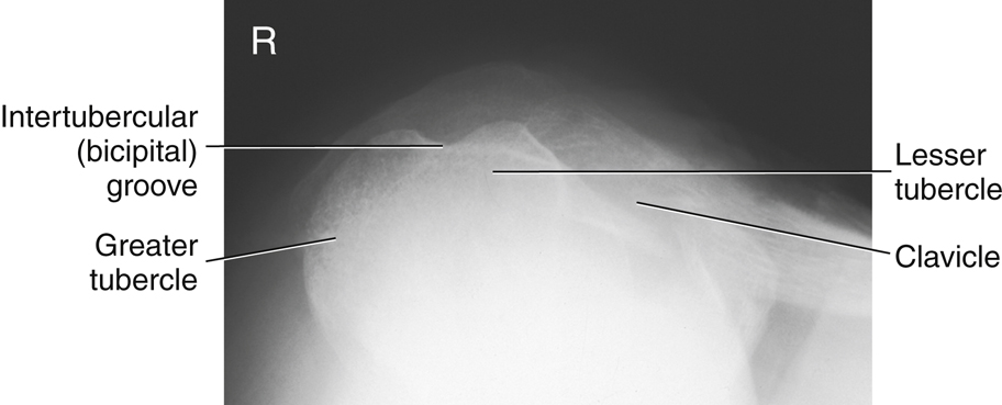 Bontrager's Textbook of Radiographic Positioning and Related Anatomy