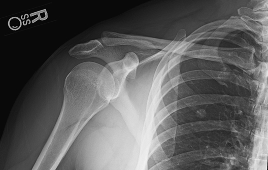 Bontrager's Textbook of Radiographic Positioning and Related Anatomy