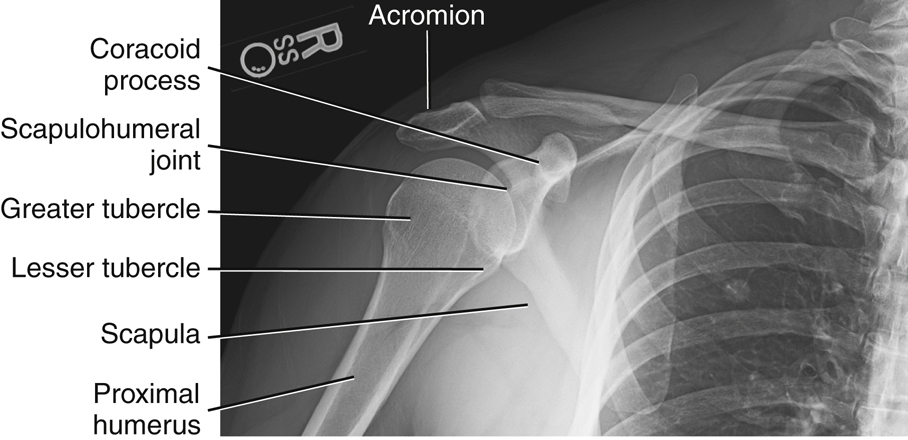 Bontrager's Textbook of Radiographic Positioning and Related Anatomy