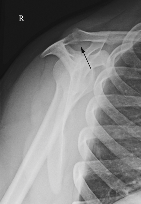 Bontrager's Textbook of Radiographic Positioning and Related Anatomy