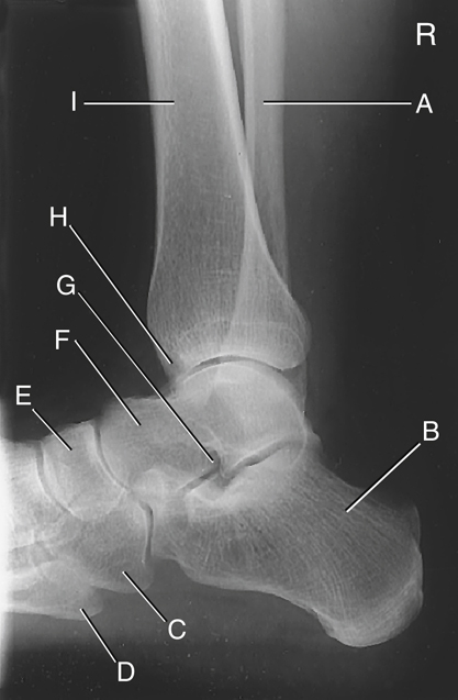 Bontrager's Textbook of Radiographic Positioning and Related Anatomy