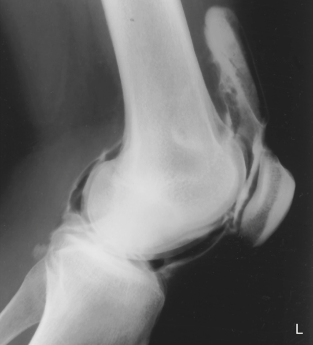 Bontrager's Textbook of Radiographic Positioning and Related Anatomy