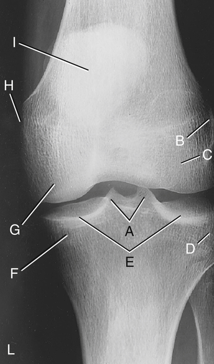 Bontrager's Textbook of Radiographic Positioning and Related Anatomy