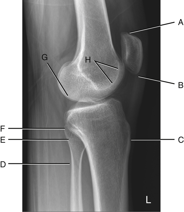 Bontrager's Textbook of Radiographic Positioning and Related Anatomy