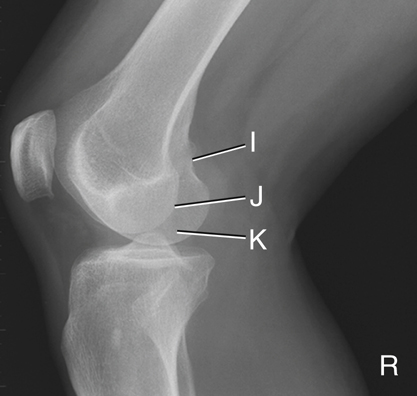 Bontrager's Textbook of Radiographic Positioning and Related Anatomy