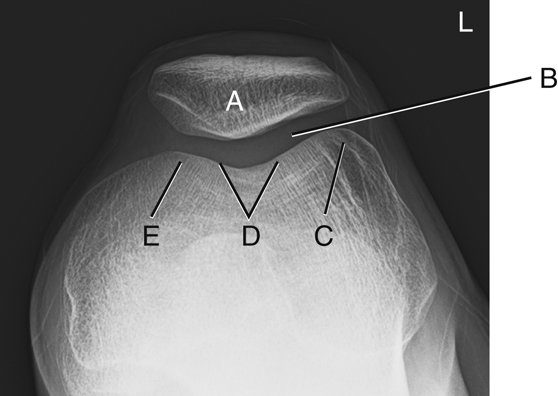 Bontrager's Textbook of Radiographic Positioning and Related Anatomy