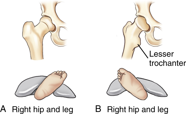 Bontrager's Textbook of Radiographic Positioning and Related Anatomy