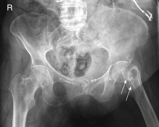 Bontrager's Textbook of Radiographic Positioning and Related Anatomy