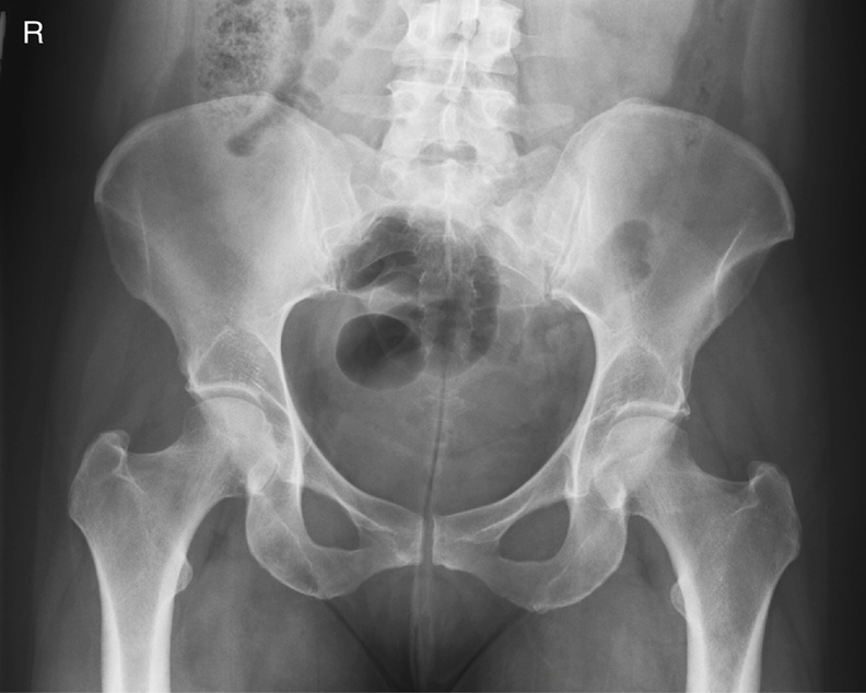 Bontrager's Textbook of Radiographic Positioning and Related Anatomy