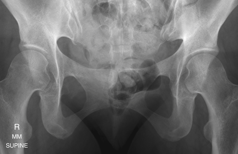 Bontrager's Textbook of Radiographic Positioning and Related Anatomy