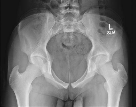 Bontrager's Textbook of Radiographic Positioning and Related Anatomy