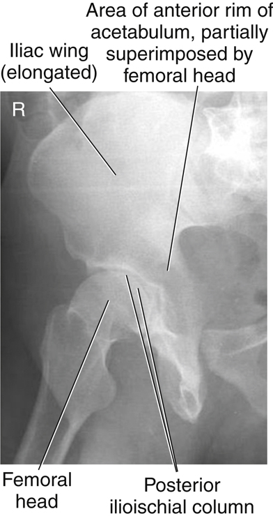 Bontrager's Textbook of Radiographic Positioning and Related Anatomy