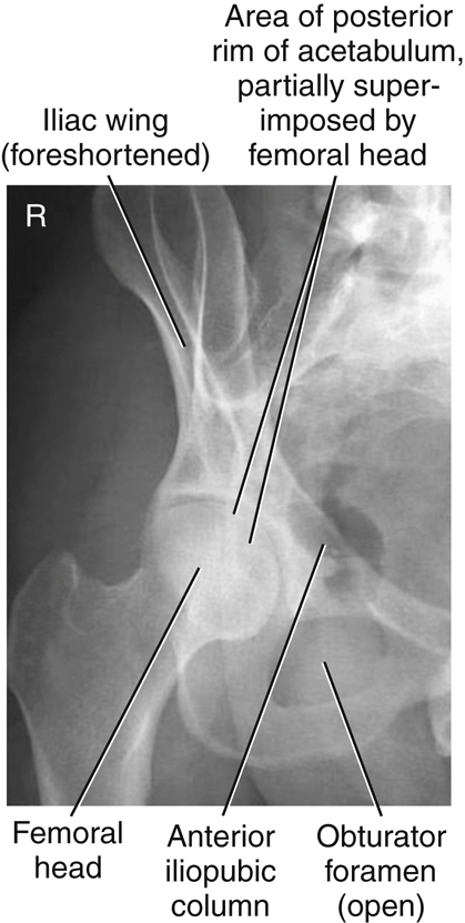 Bontrager's Textbook of Radiographic Positioning and Related Anatomy