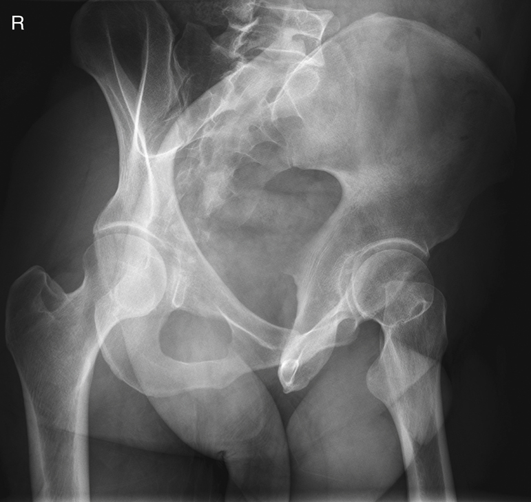 Bontrager's Textbook of Radiographic Positioning and Related Anatomy