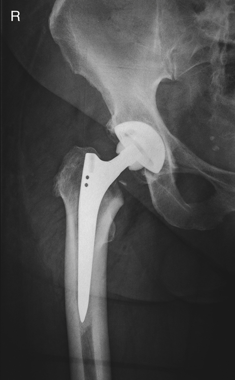 Bontrager's Textbook of Radiographic Positioning and Related Anatomy