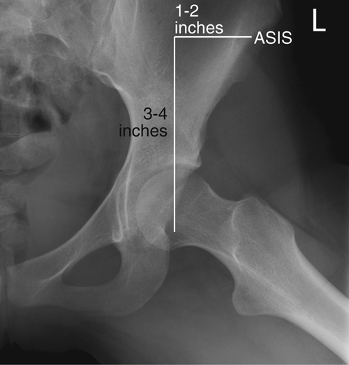 Bontrager's Textbook of Radiographic Positioning and Related Anatomy