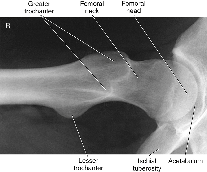 Bontrager's Textbook of Radiographic Positioning and Related Anatomy