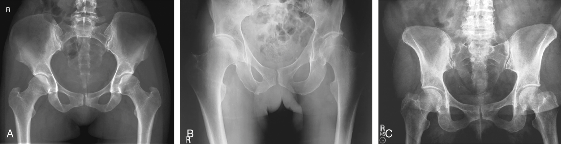 Bontrager's Textbook of Radiographic Positioning and Related Anatomy