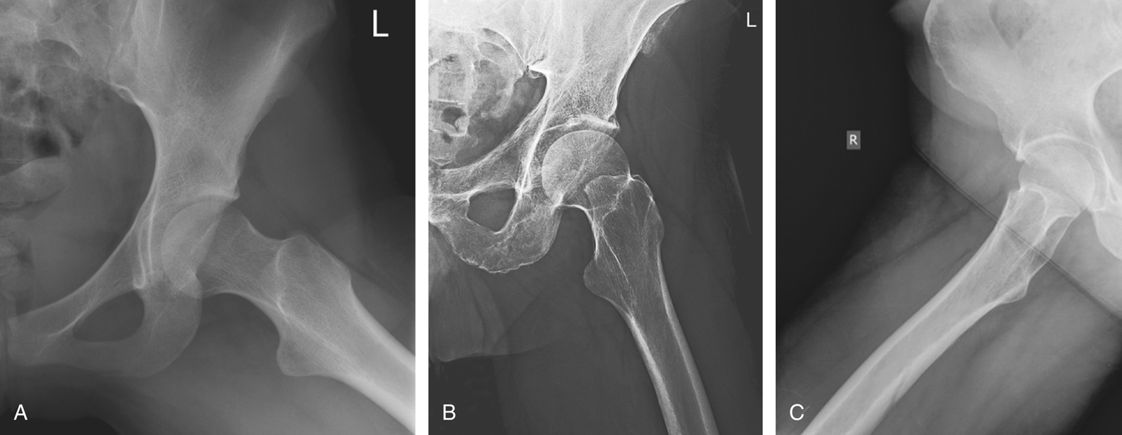 Bontrager's Textbook of Radiographic Positioning and Related Anatomy
