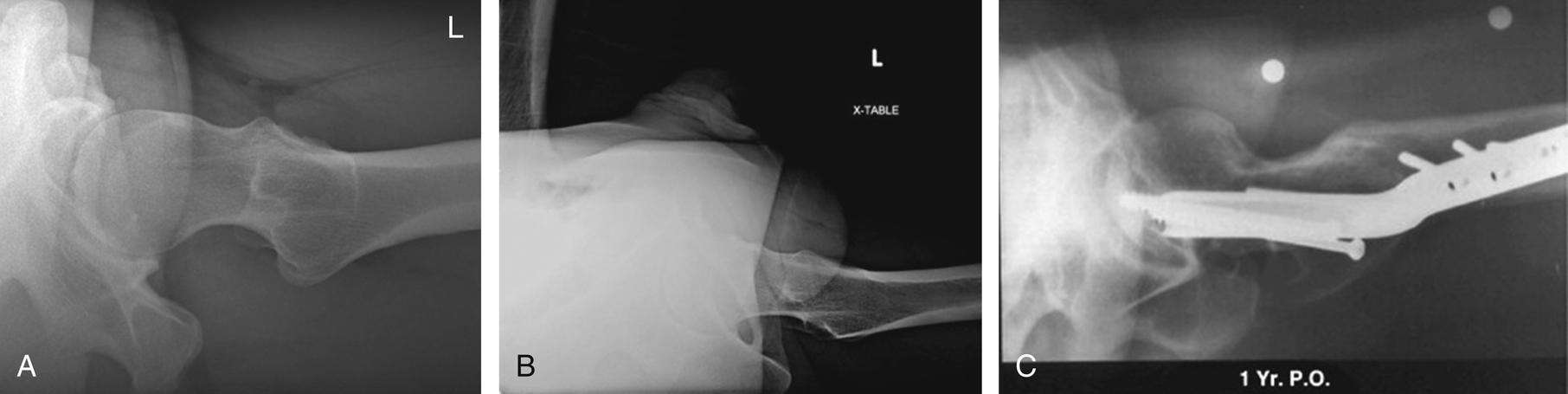 Bontrager's Textbook of Radiographic Positioning and Related Anatomy