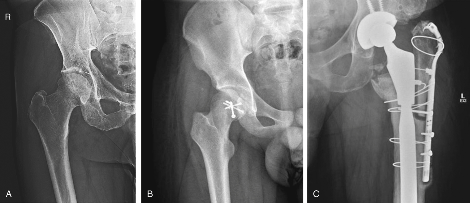 Bontrager's Textbook of Radiographic Positioning and Related Anatomy