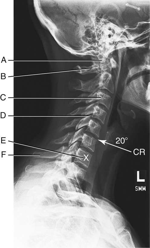 Bontrager's Textbook of Radiographic Positioning and Related Anatomy
