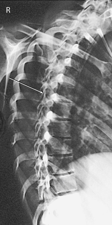Bontrager's Textbook of Radiographic Positioning and Related Anatomy