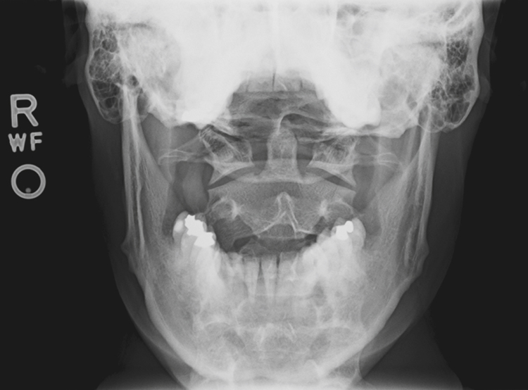 Bontrager's Textbook of Radiographic Positioning and Related Anatomy