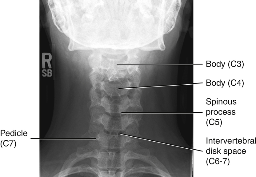 Bontrager's Textbook of Radiographic Positioning and Related Anatomy