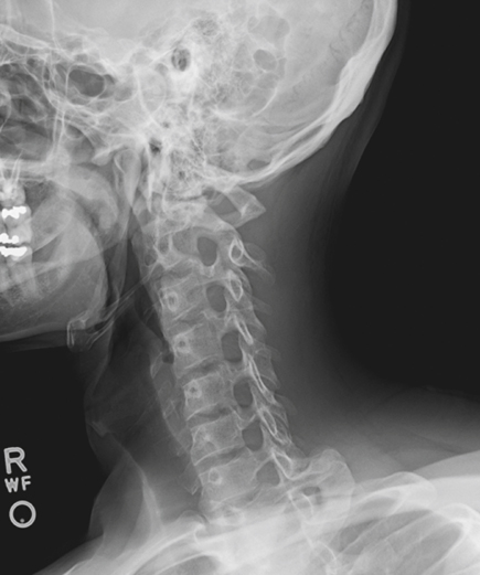 Bontrager's Textbook of Radiographic Positioning and Related Anatomy