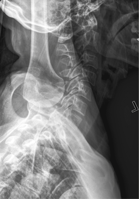 Bontrager's Textbook of Radiographic Positioning and Related Anatomy