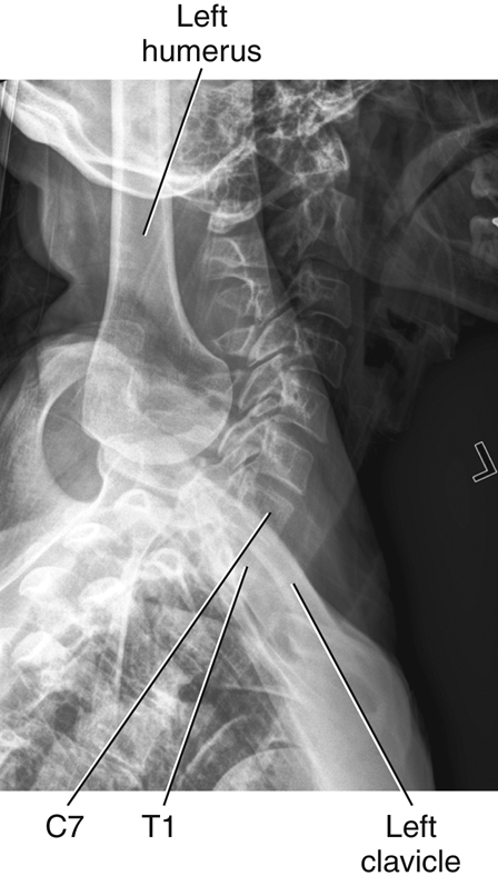 Bontrager's Textbook of Radiographic Positioning and Related Anatomy